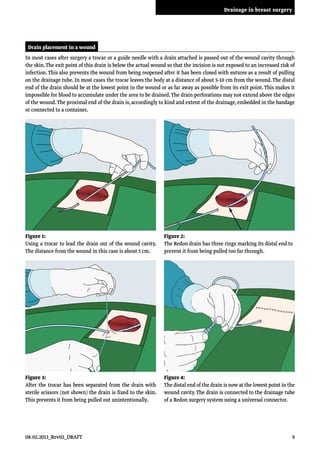 Wound drainage-information-booklet-pue1201 | PDF