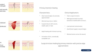 Principles of wound and wound healing in surgery.pptx