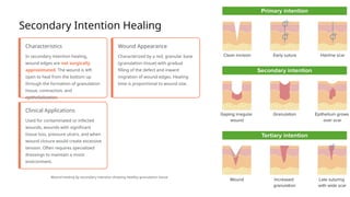 Principles of wound and wound healing in surgery.pptx