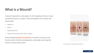 Principles of wound and wound healing in surgery.pptx