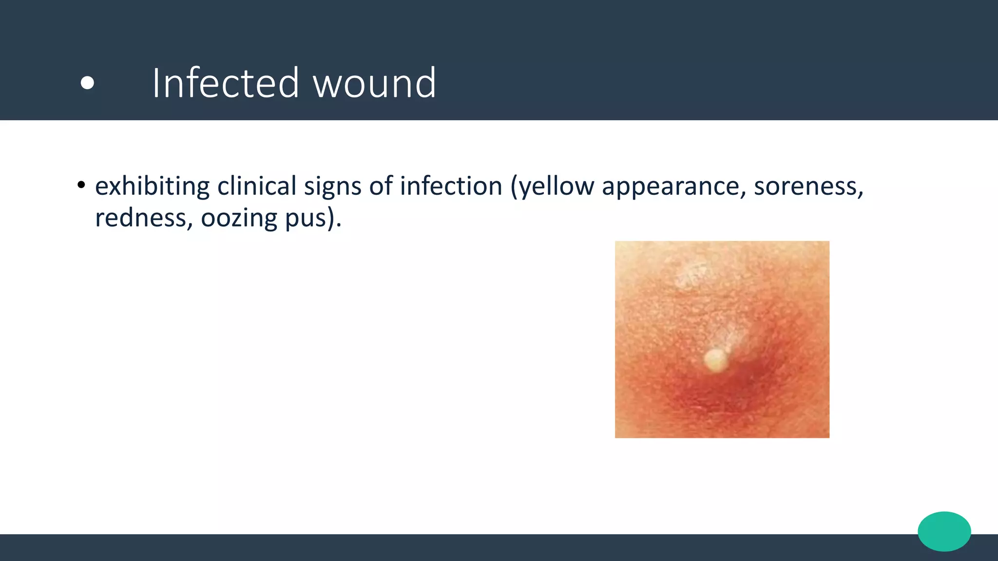 Wound management and surgical products | PPTX
