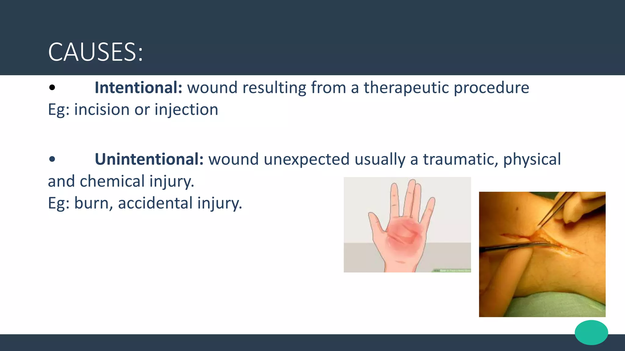 Wound management and surgical products | PPTX
