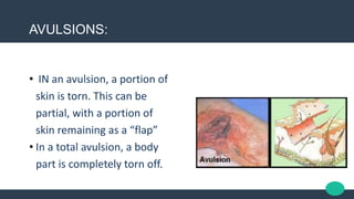 Wound management and surgical products | PPT