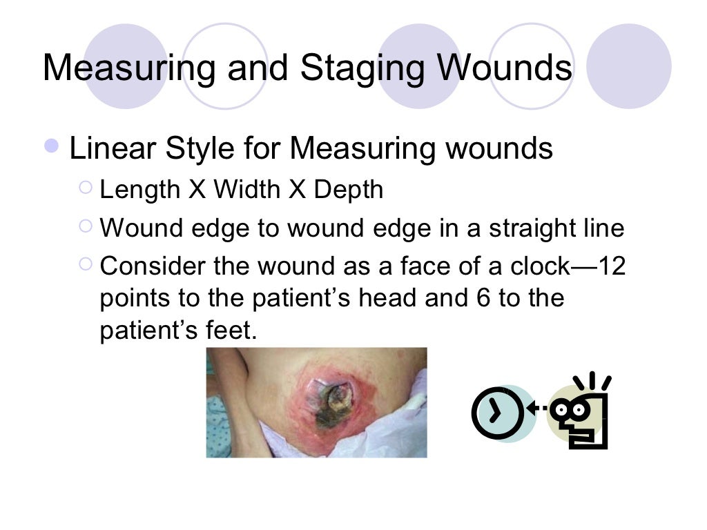 Wound Measuring And Staging Inservice