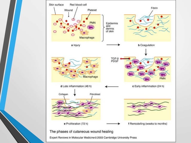 Wound and Bone healing | PPT