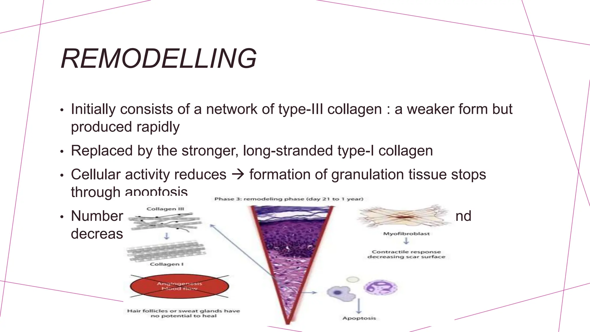 Stages of Wound and Bone Healing (Ortho) | PPTX