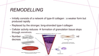 Stages of Wound and Bone Healing (Ortho) | PPTX | Blood Disorders ...