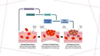 Stages of Wound and Bone Healing (Ortho) | PPTX