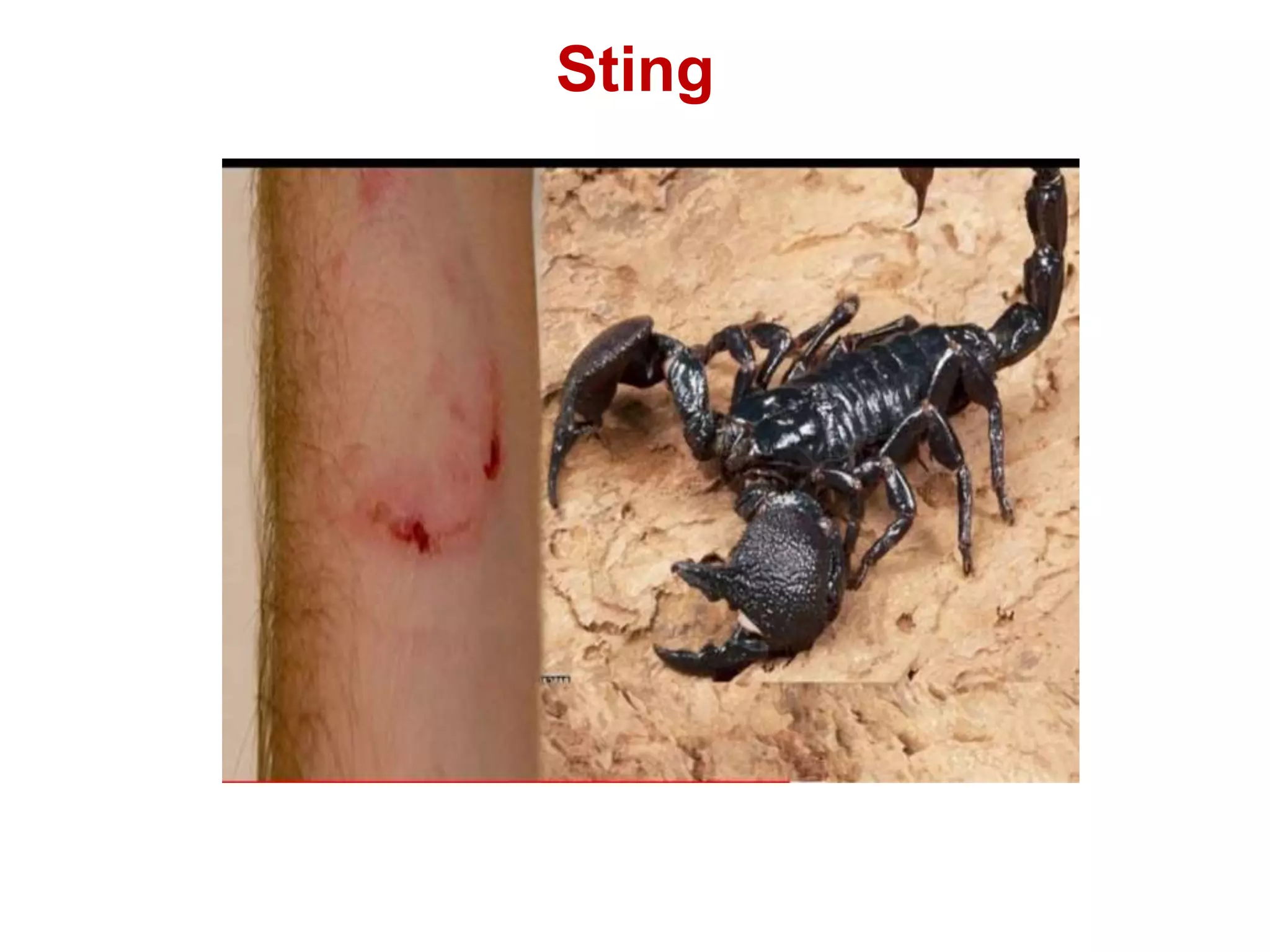 Wound and Rabies Prevention.pptx