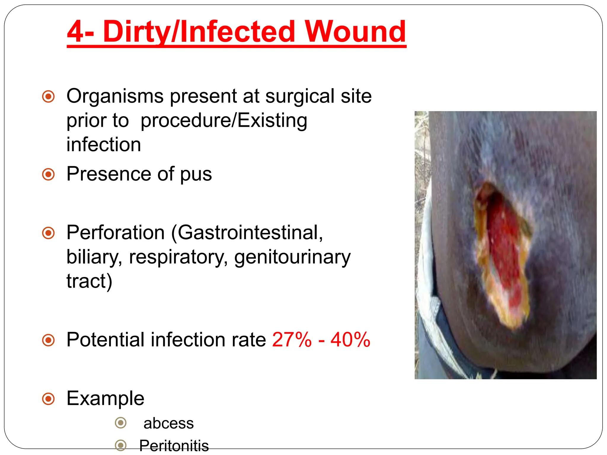 wound and types wound healing and dressing.pptx