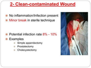 wound and types wound healing and dressing.pptx