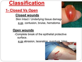 wound and types wound healing and dressing.pptx