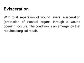 Wound and wound drainage.pptx