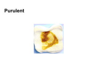 Serosanguinous Drainage