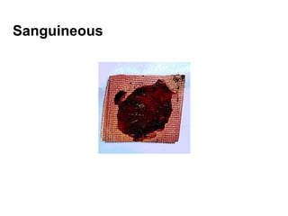 Sanguineous Wound