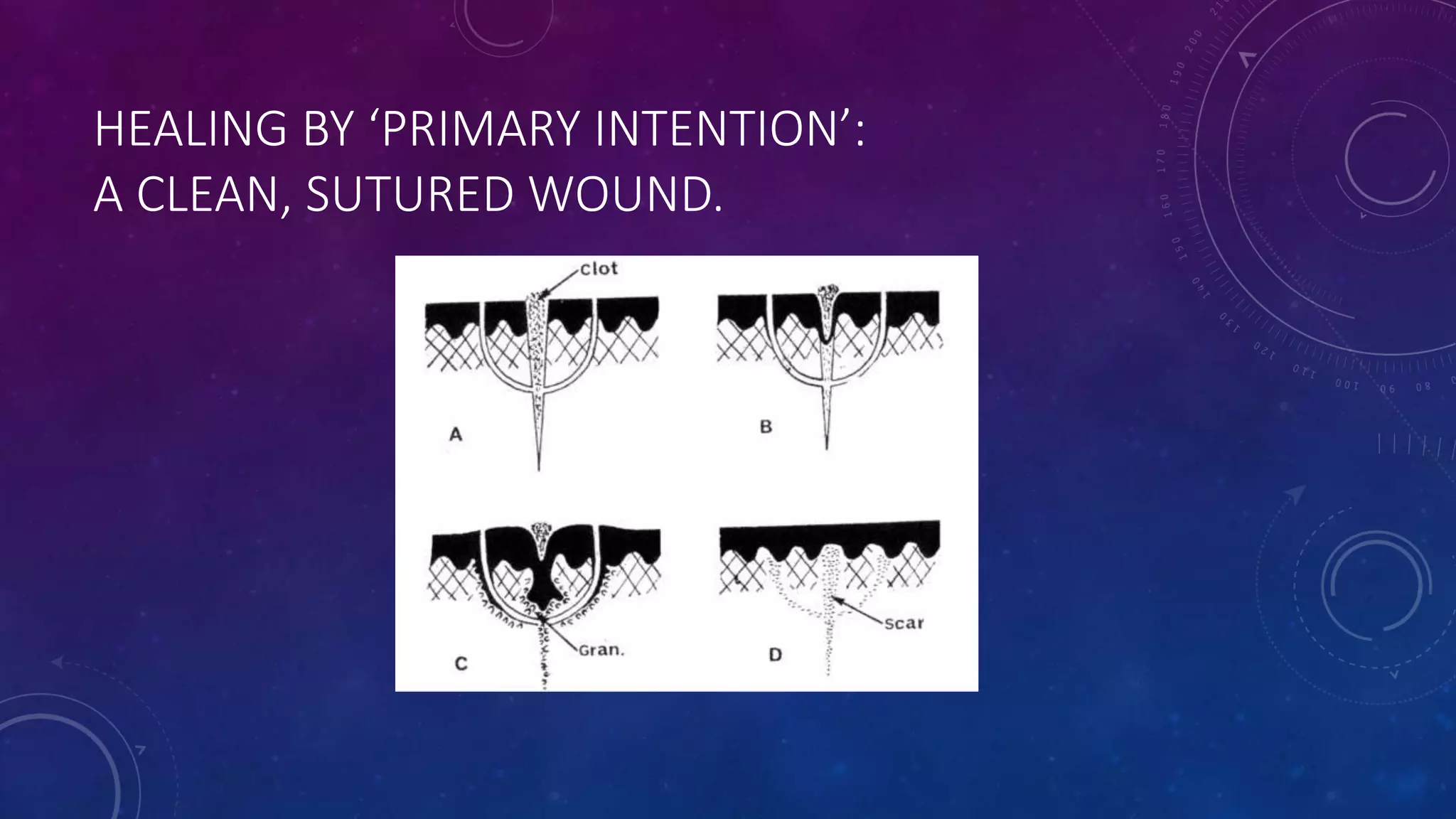 Wound and wound healing | PPTX