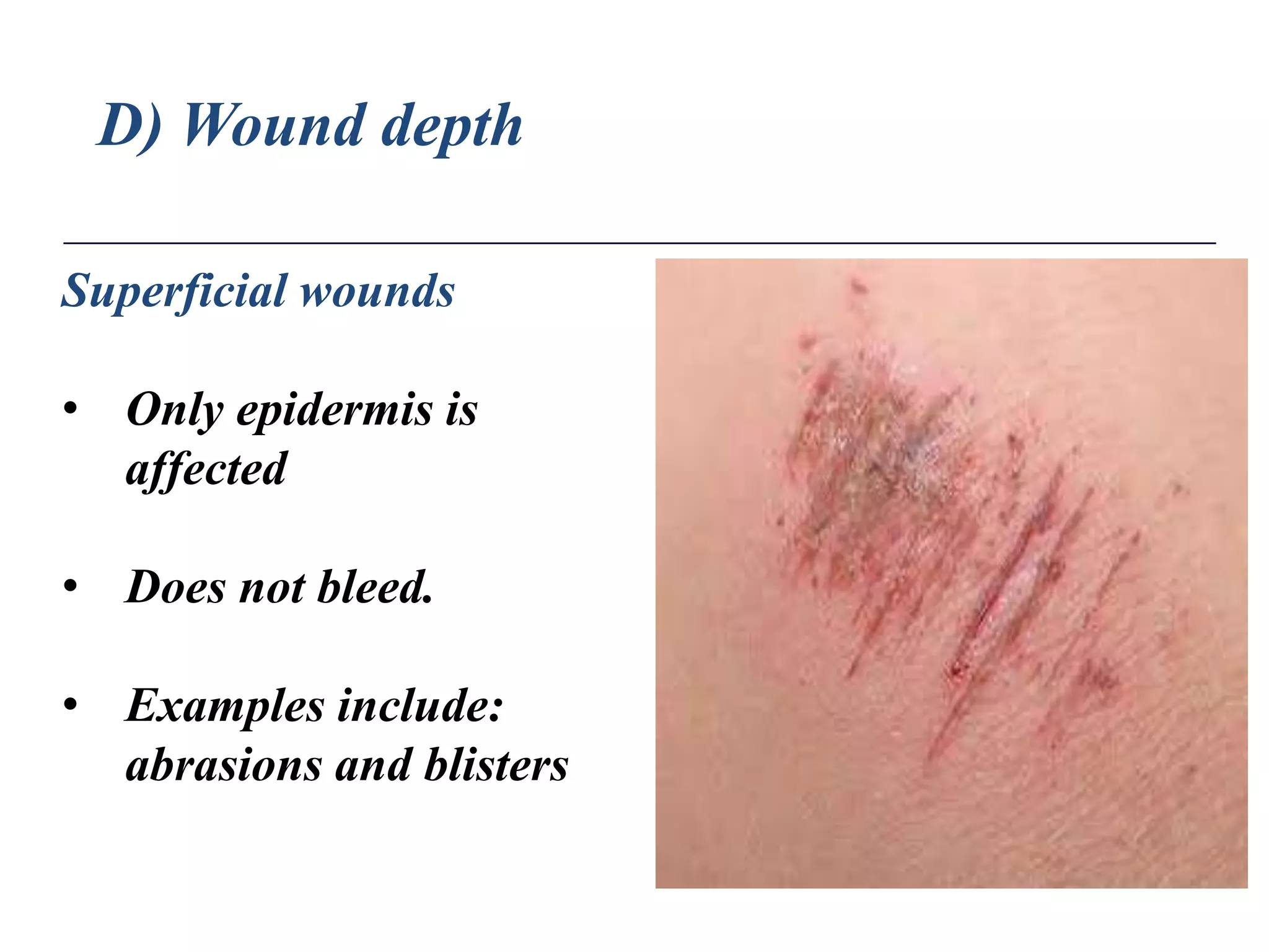 Wound and Wound healing | PPTX