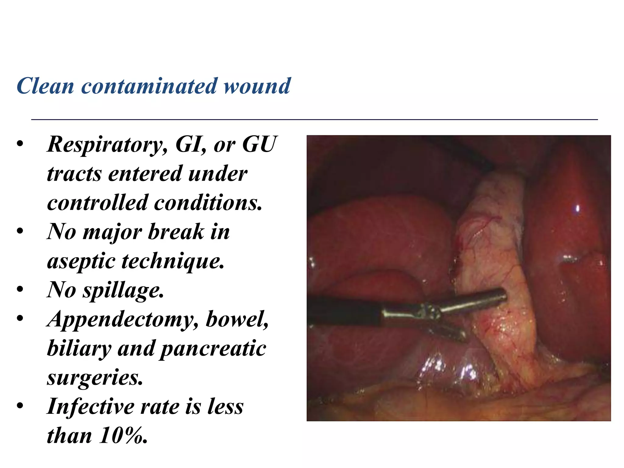 Wound and Wound healing | PPTX
