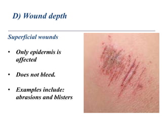 Wound and Wound healing | PPTX