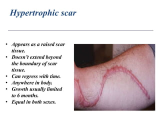 Wound and Wound healing | PPTX