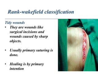 Wound and Wound healing | PPT