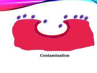 Wound Assessment | PPTX