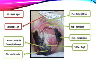Wound Assessment | PPTX