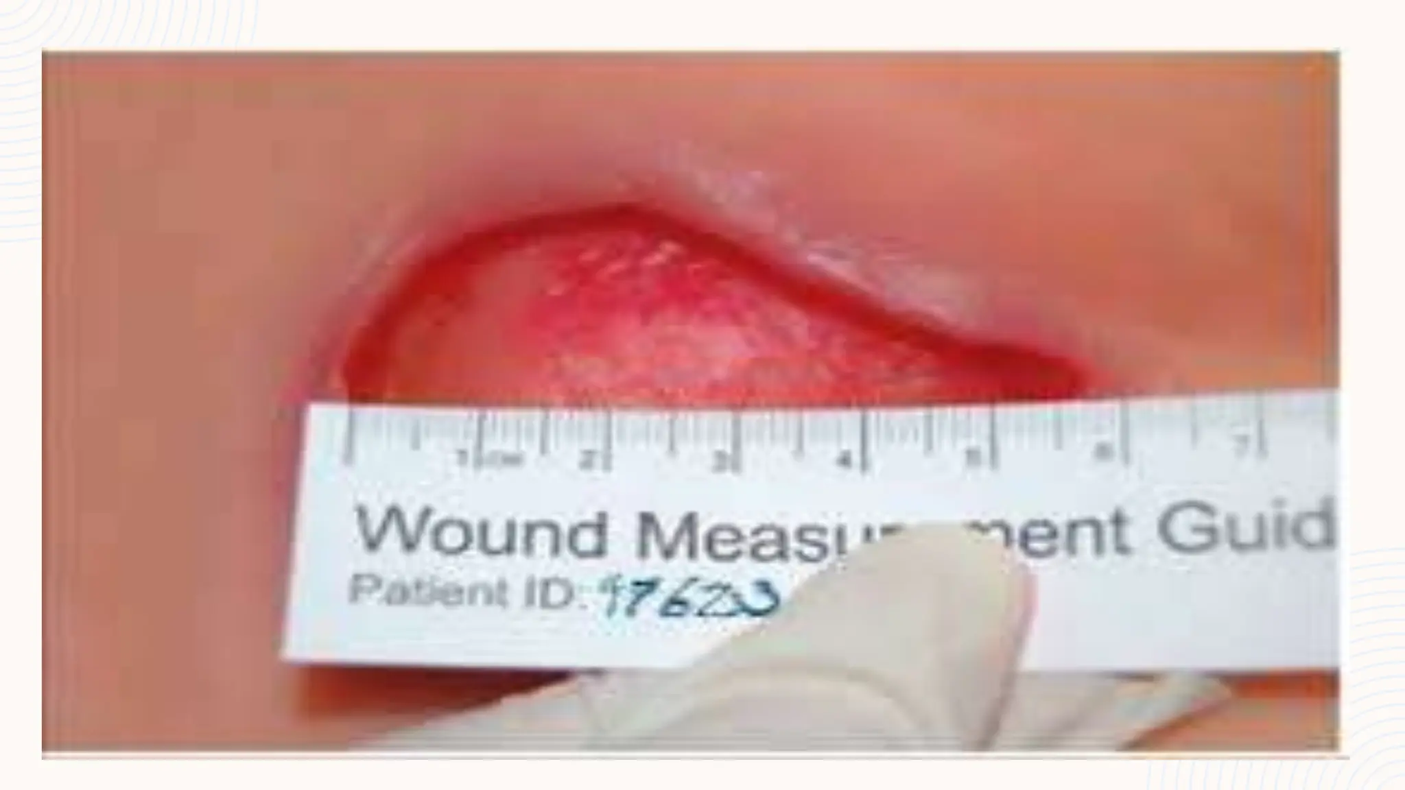Wound assessment and documentation HOSPITAL mERSING.pptx