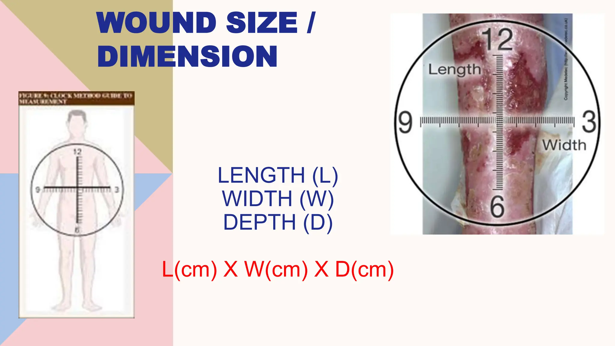 Wound assessment and documentation HOSPITAL mERSING.pptx