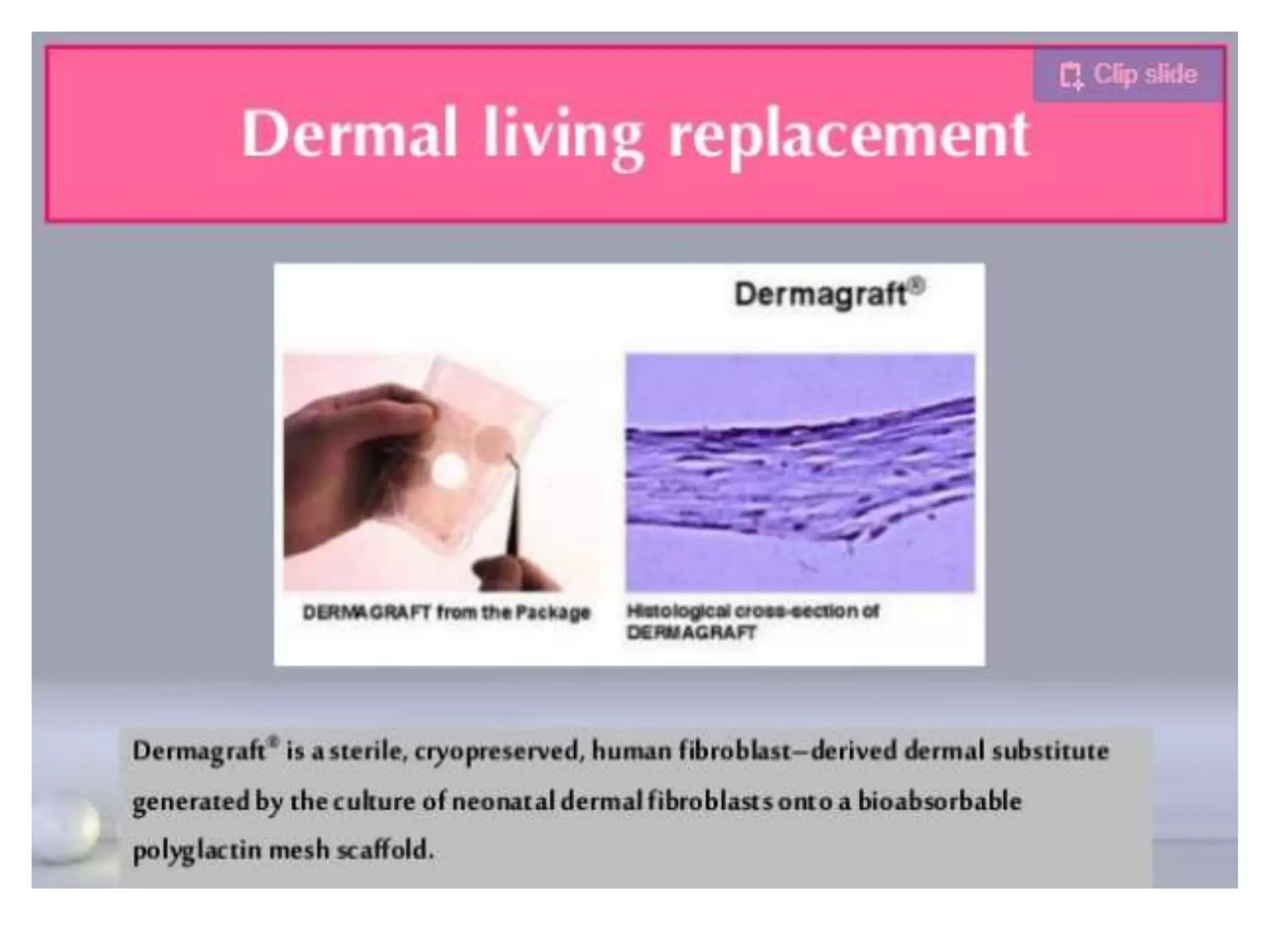 Wound assessment and modern dressing | PPTX