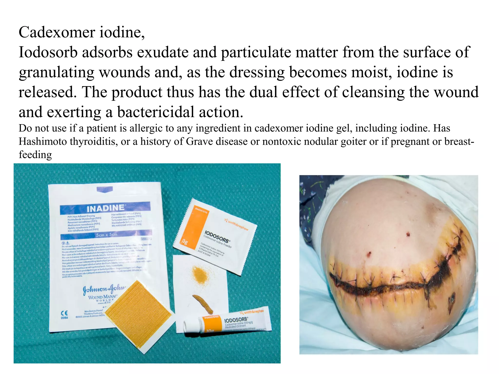 Wound assessment and products | PPT