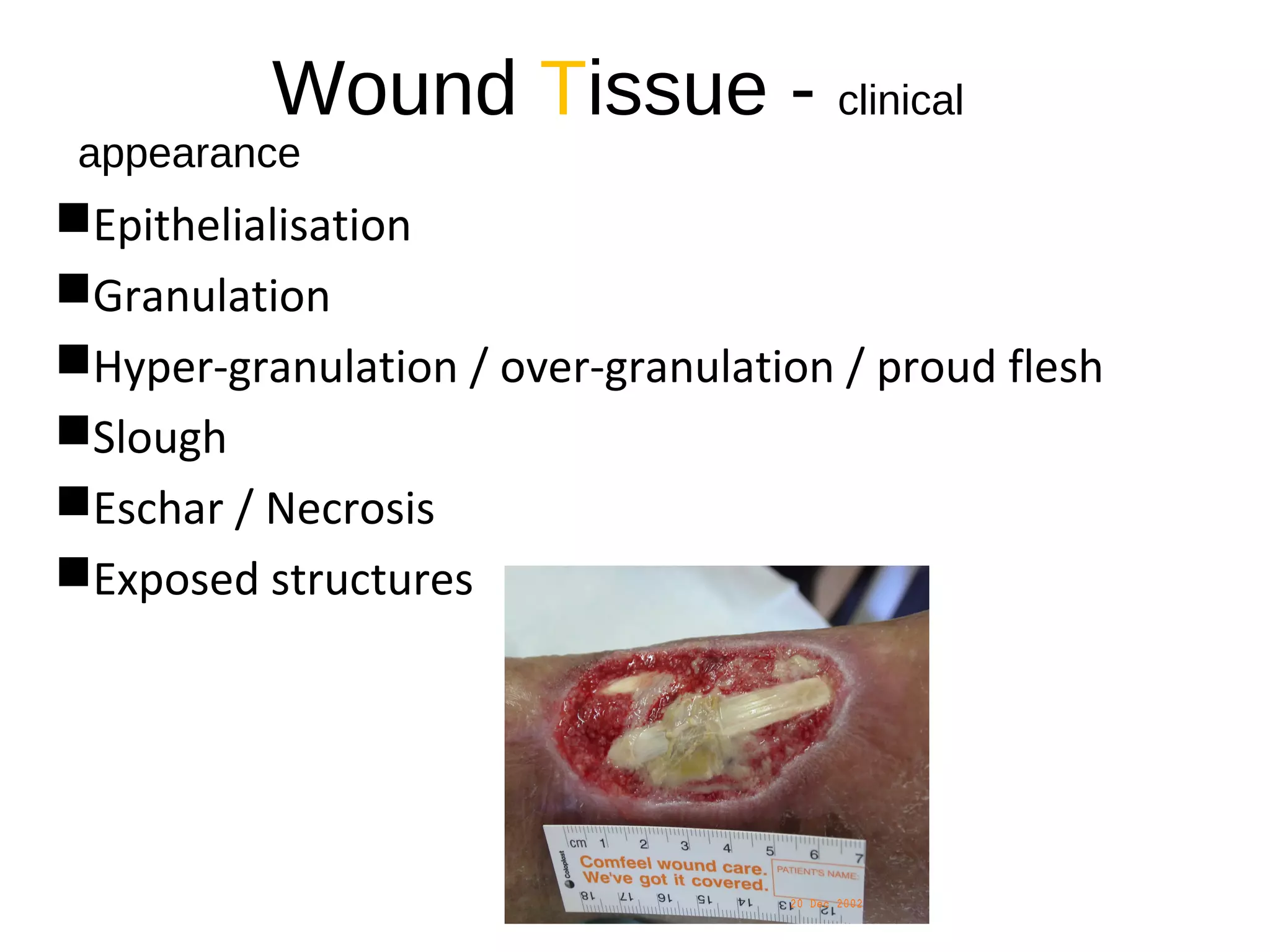 Wound assessment and products | PPT