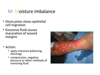 Wound assessment and products | PPT