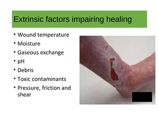Wound assessment and products | PPT