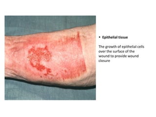 Wound assessment and products | PPT