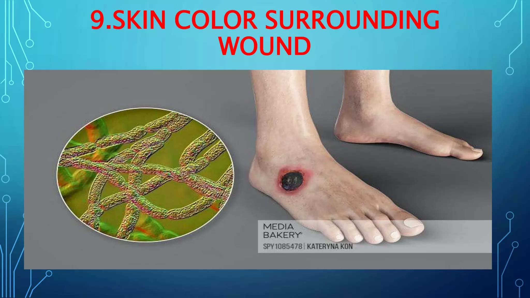 wound assessment tools.pptx