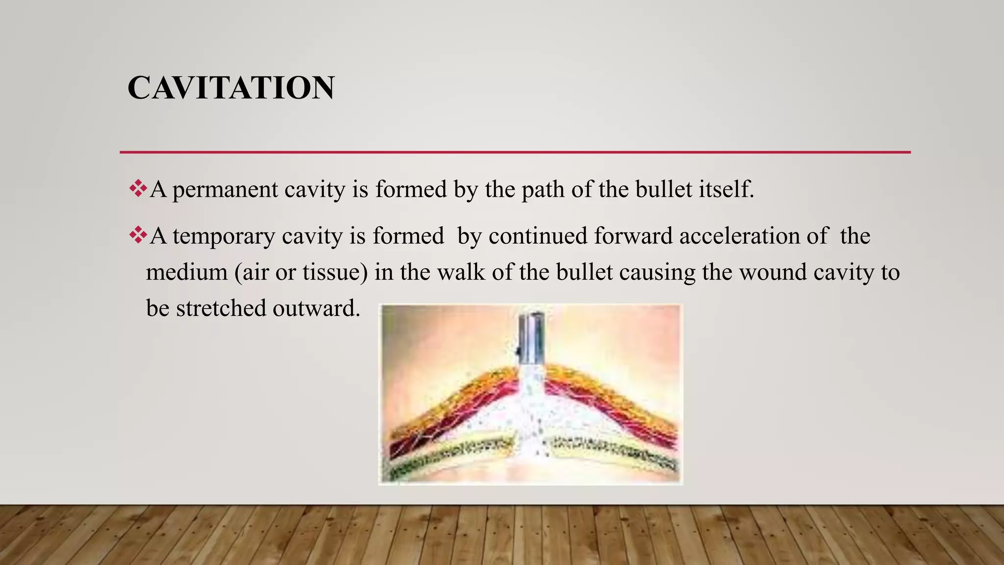 Wound Ballistics Of Rifled Firearm.pptx