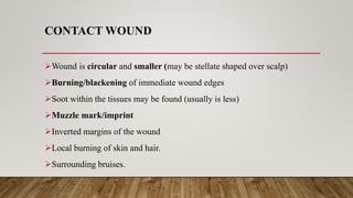 Wound Ballistics Of Rifled Firearm.pptx