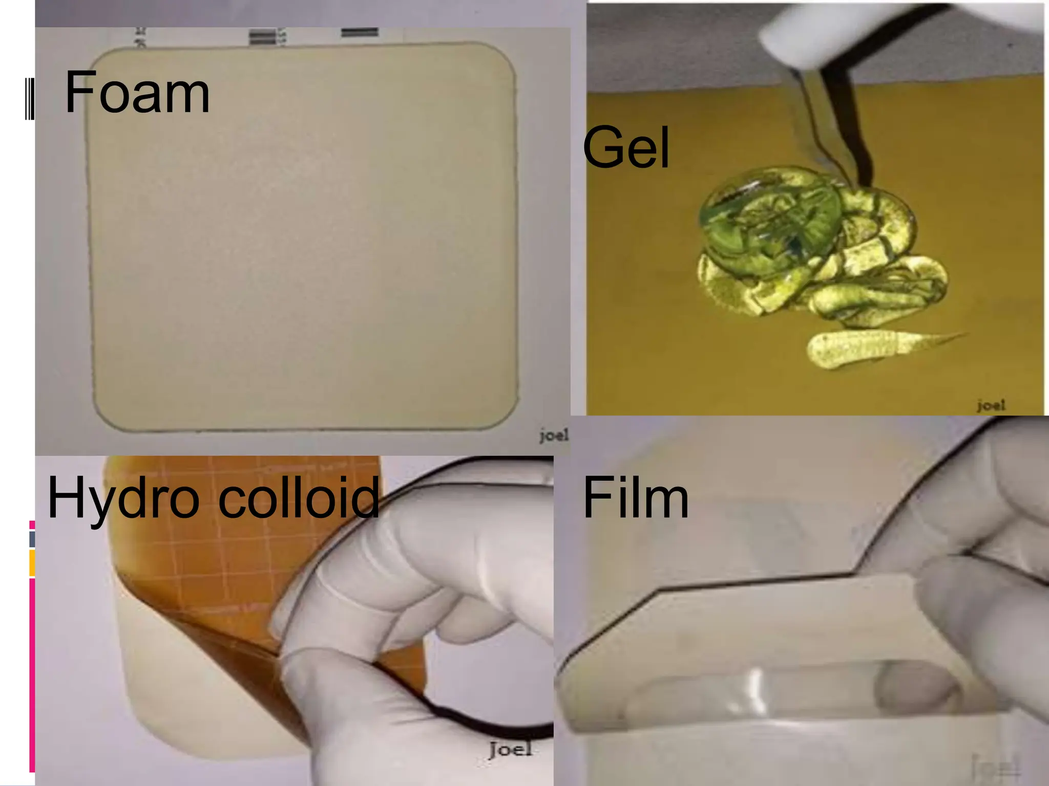 Wound Bed Preparation Joel Arudchelvam.pptx