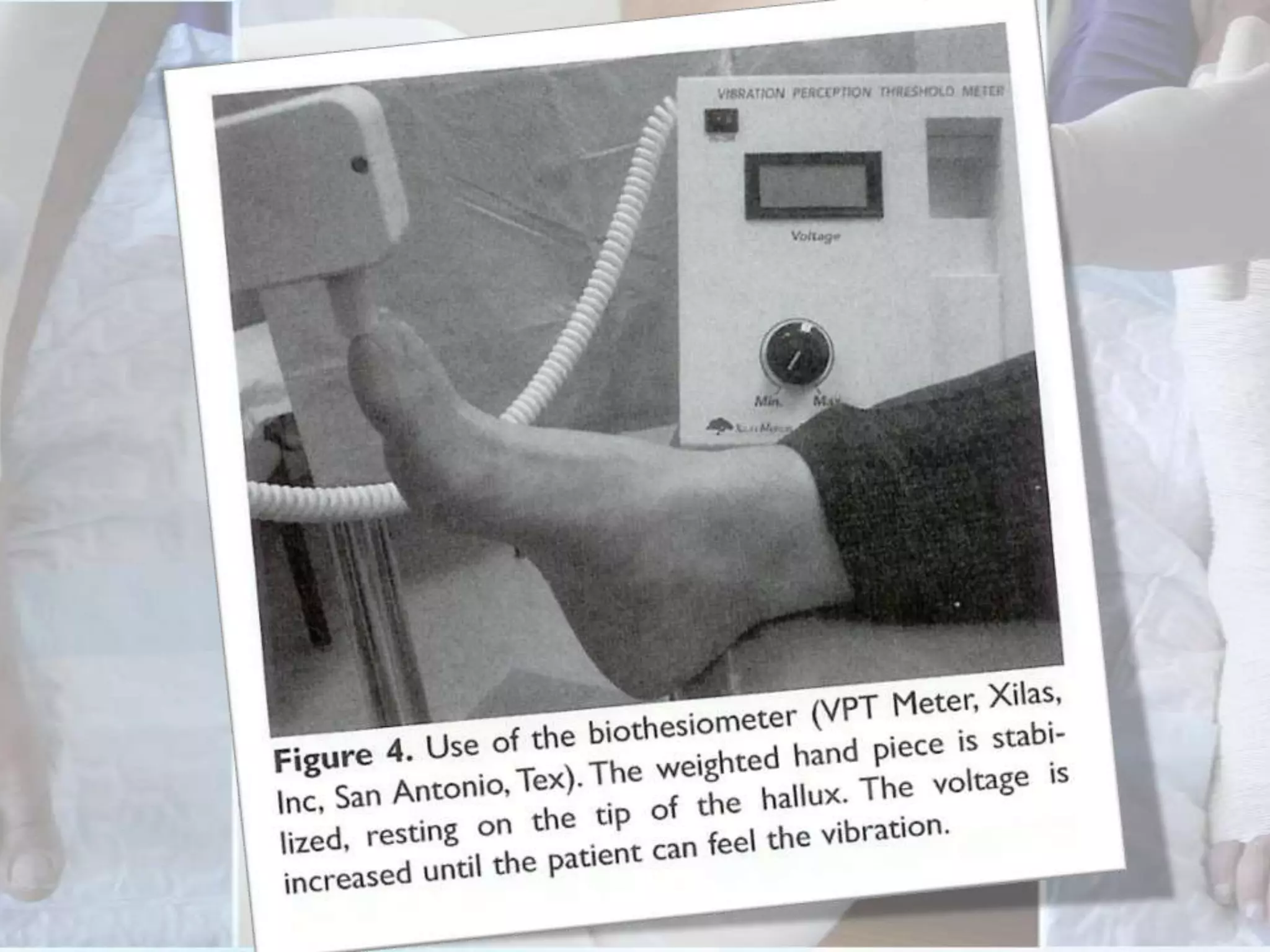 Diabetic Foot Examination | PPTX