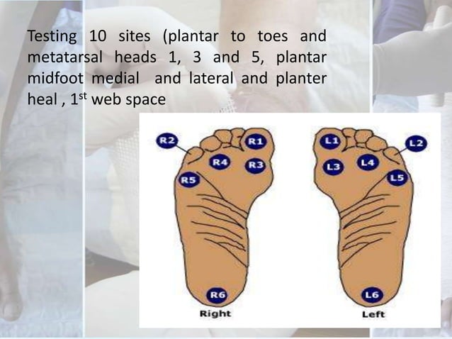 Diabetic Foot Examination | PPTX | Death, Injury, or Military Conflict ...