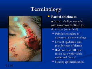 Wound care | PPT