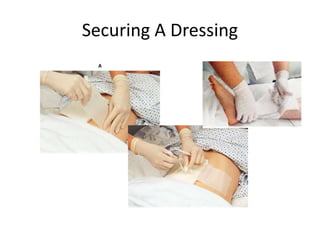 Montgomery Straps For Wounds