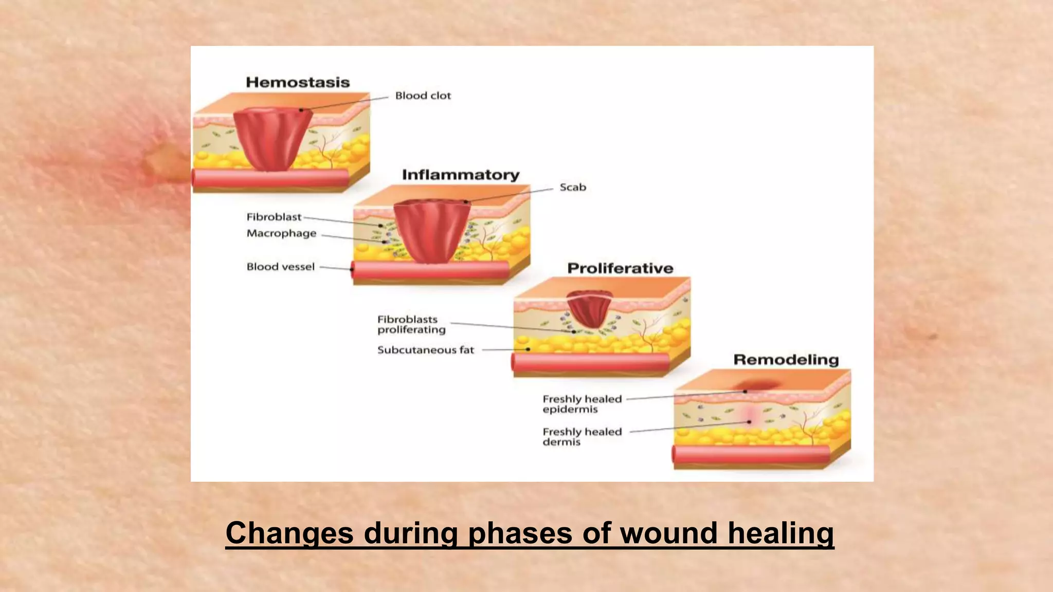 wound care.pptx