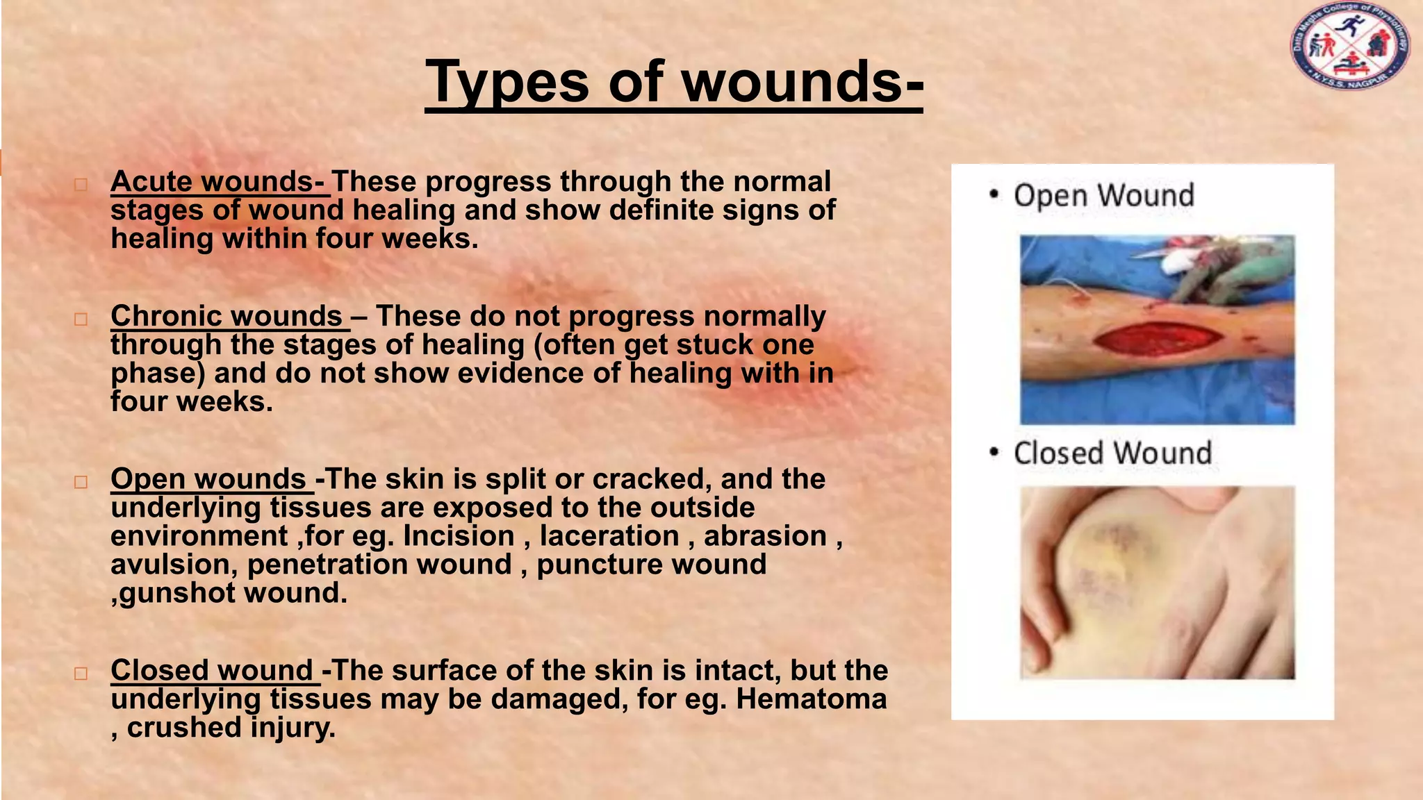 wound care.pptx