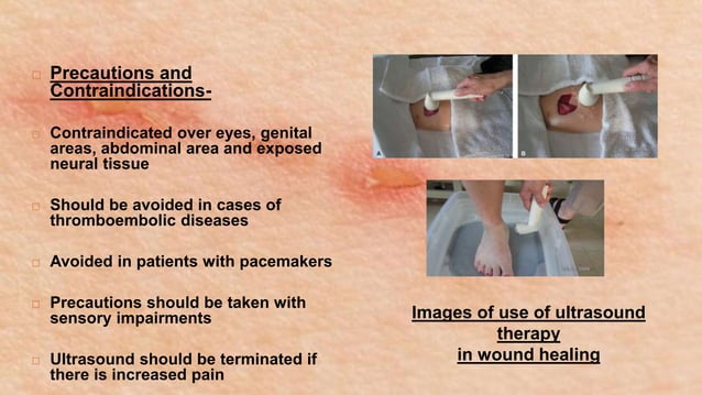 wound care.pptx