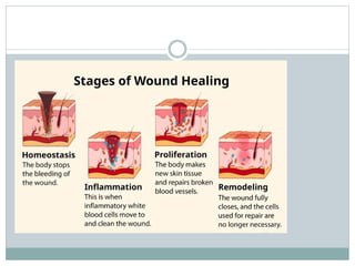 Wound care involves cleaning, protecting, and monitoring wounds to ...