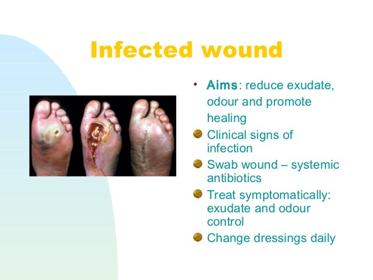 Wound care 09
