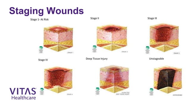 Wound Care 101 | PPTX | Physical Therapy | Wellness