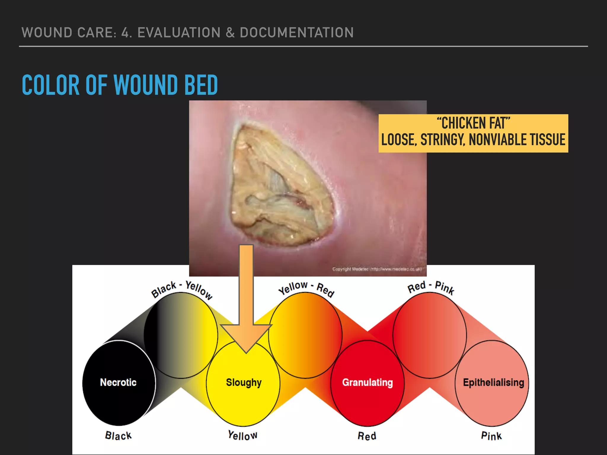 Wound care | PDF